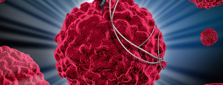 How to Invest in Cancer’s New Enemy - Curzio Research